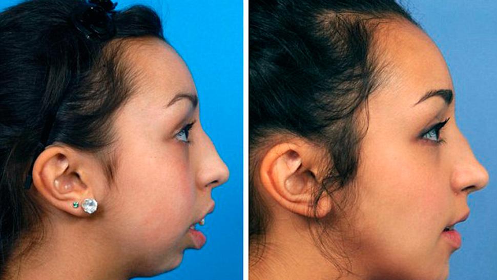 Se operó la boca y quedó totalmente irreconocible - LA GACETA Tucumán