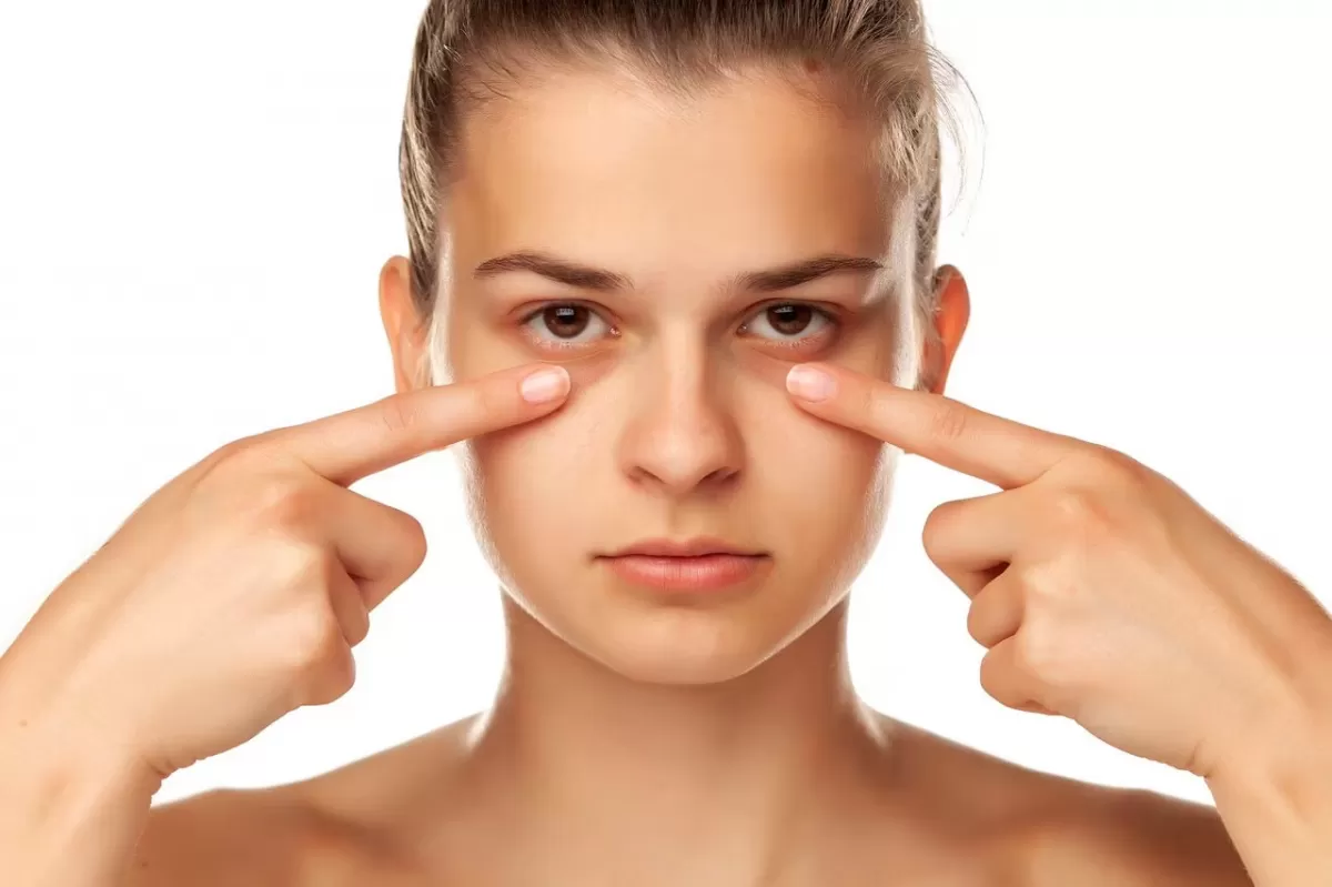 ¿Por qué salen las ojeras y cómo hacer para eliminarlas? ¿Por qué salen las ojeras y cómo hacer para eliminarlas?
